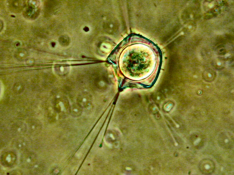 Les Rhizopodes